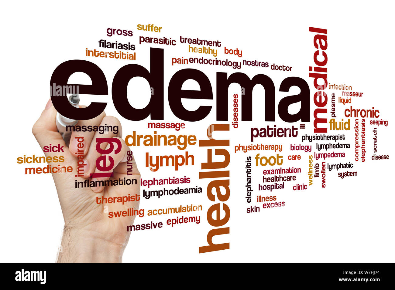 Edema word cloud concept Stock Photo - Alamy