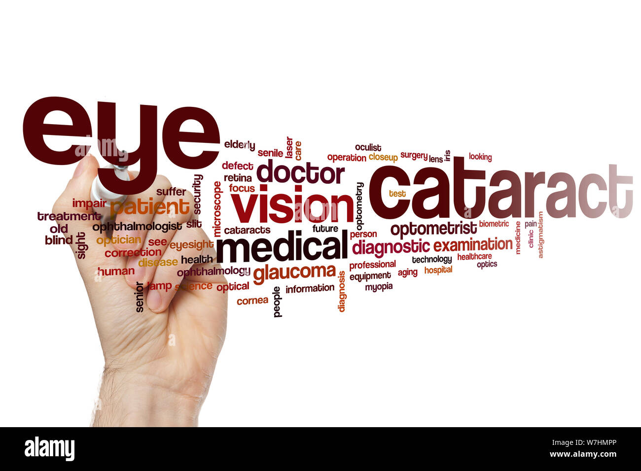 Eye cataract word cloud concept Stock Photo - Alamy