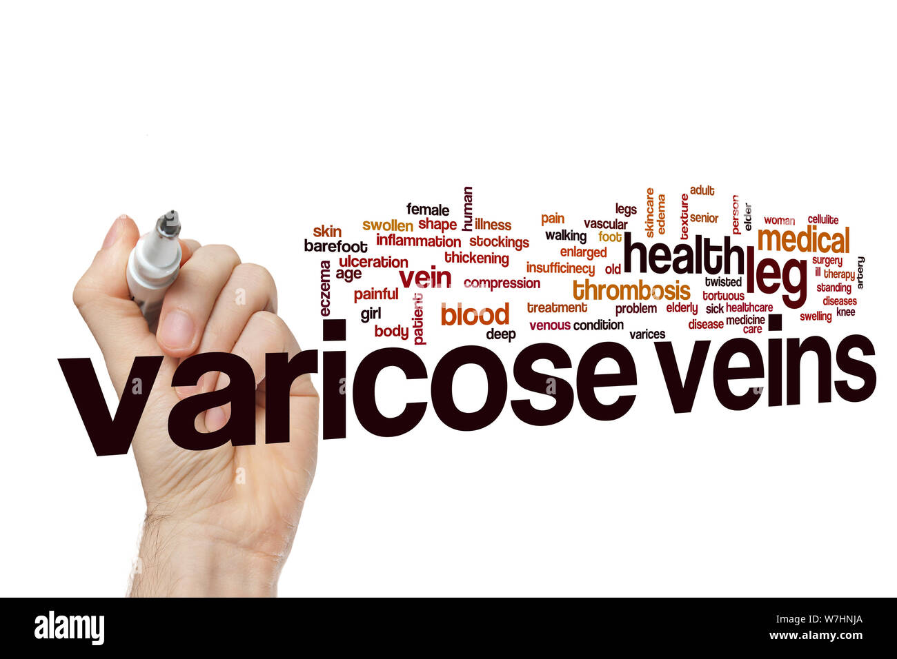 Varicose veins word cloud Stock Photo - Alamy