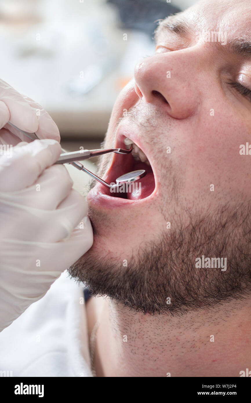 Wide open mouth dentist hi-res stock photography and images - Alamy