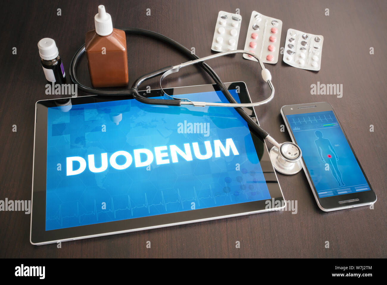 Duodenum (gastrointestinal disease related organ) diagnosis medical ...