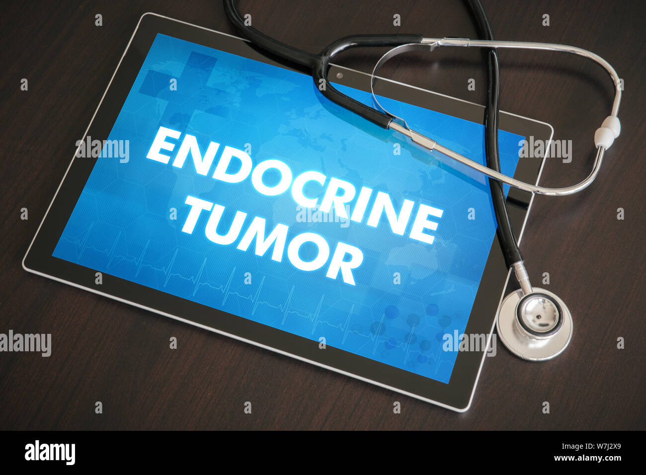 Endocrine tumor (endocrine disease) diagnosis medical concept on tablet ...