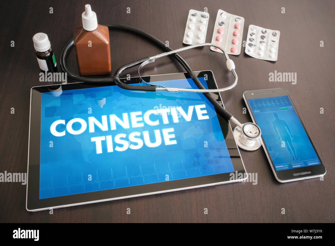 Connective tissue (gastrointestinal disease related) diagnosis medical ...