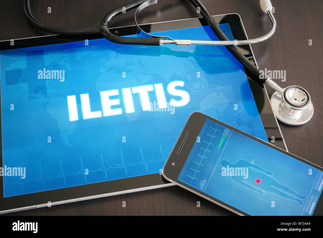 Ileitis (gastrointestinal disease) diagnosis medical concept on tablet ...