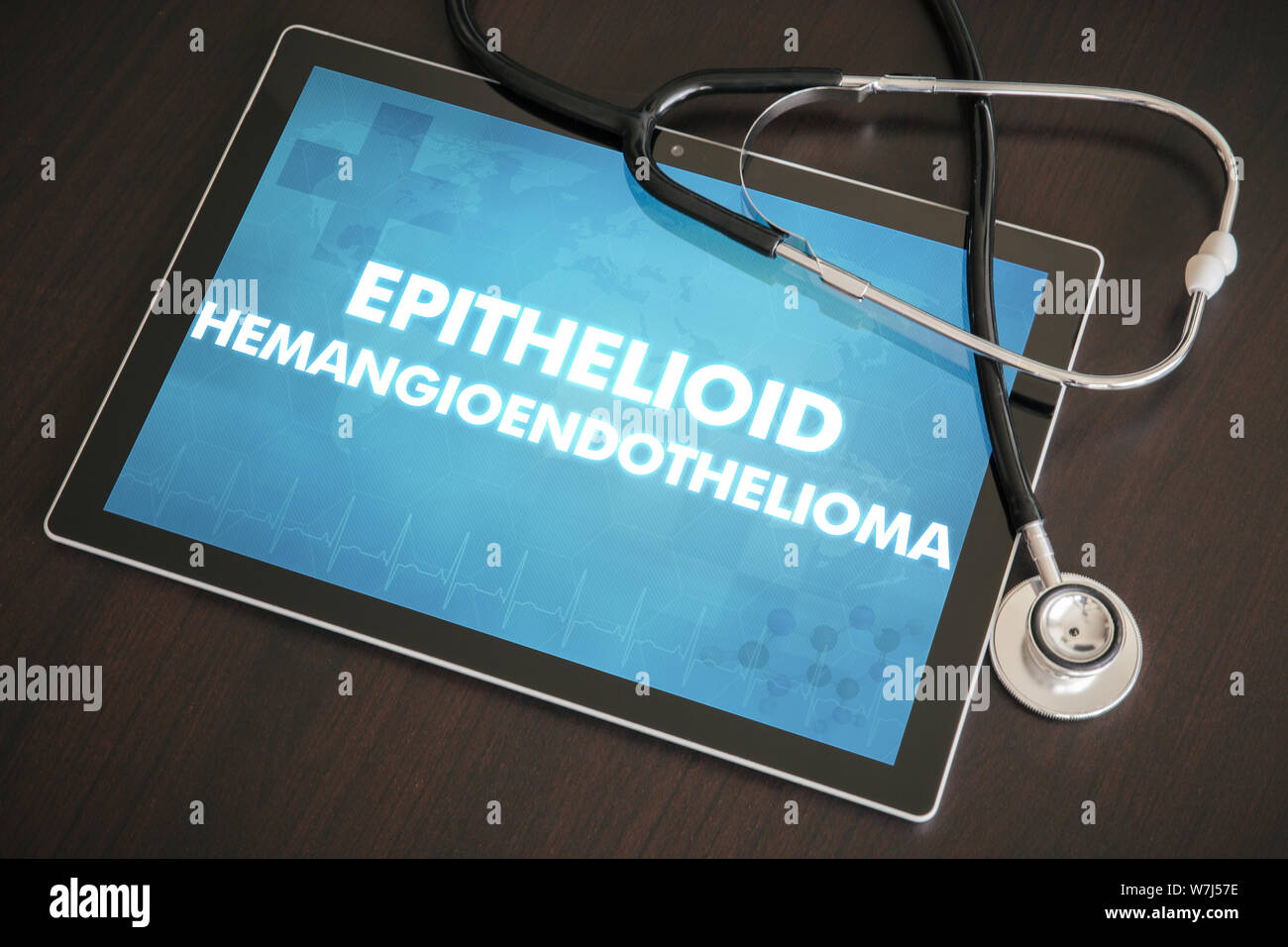 Epithelioid hemangioendothelioma (cancer type) diagnosis medical ...