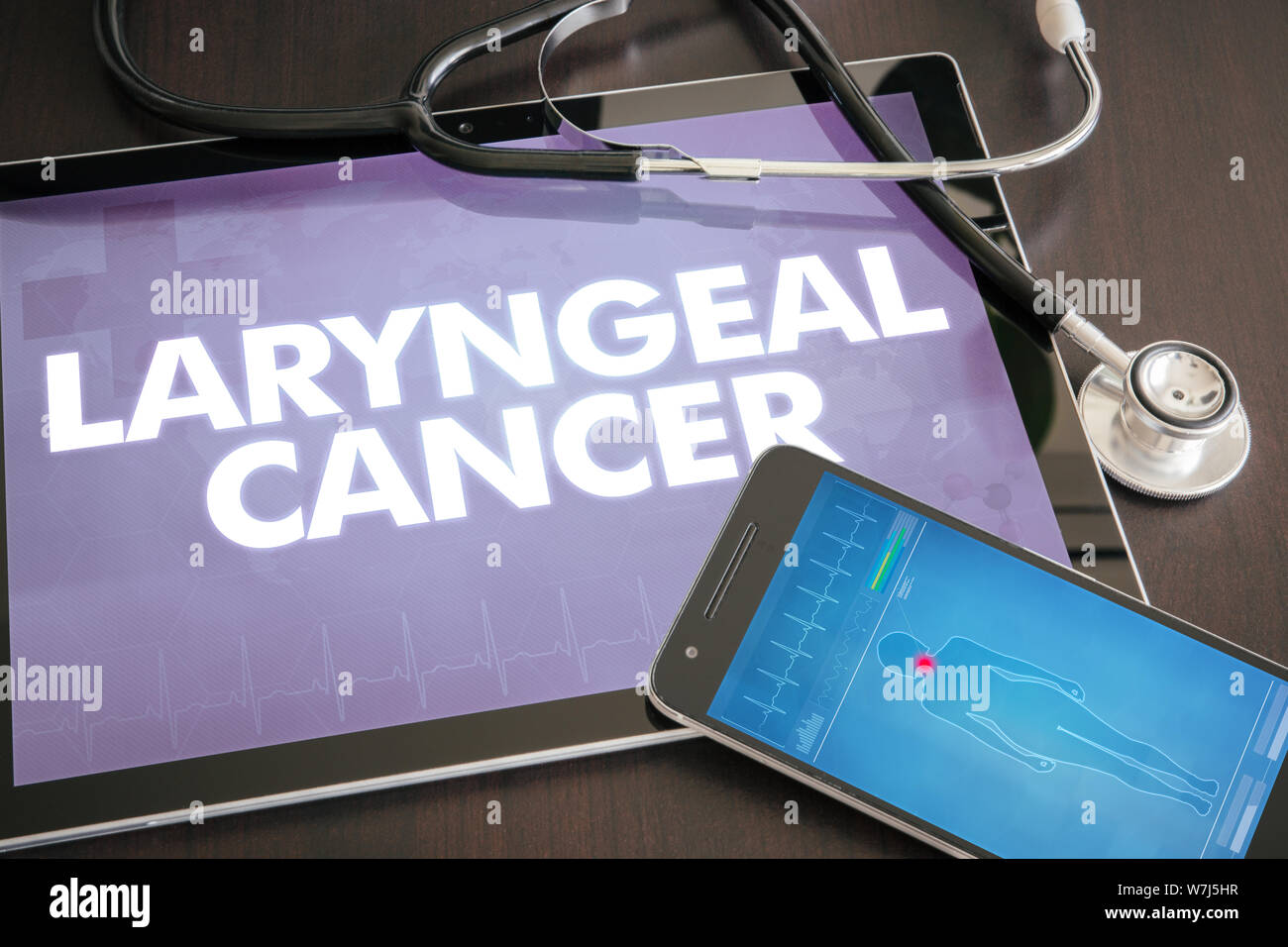Laryngeal cancer hi-res stock photography and images - Alamy