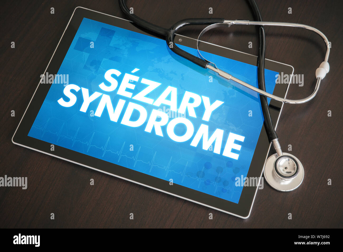 Sezary syndrome hi-res stock photography and images - Alamy