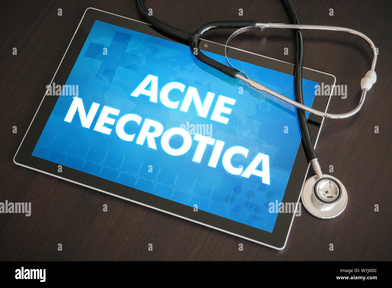 Acne necrotica (cutaneous disease) diagnosis medical concept on tablet ...
