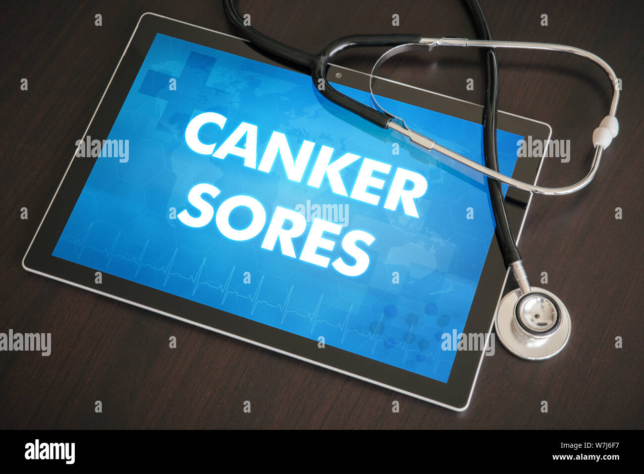 Canker sores (cutaneous disease) diagnosis medical concept on tablet ...