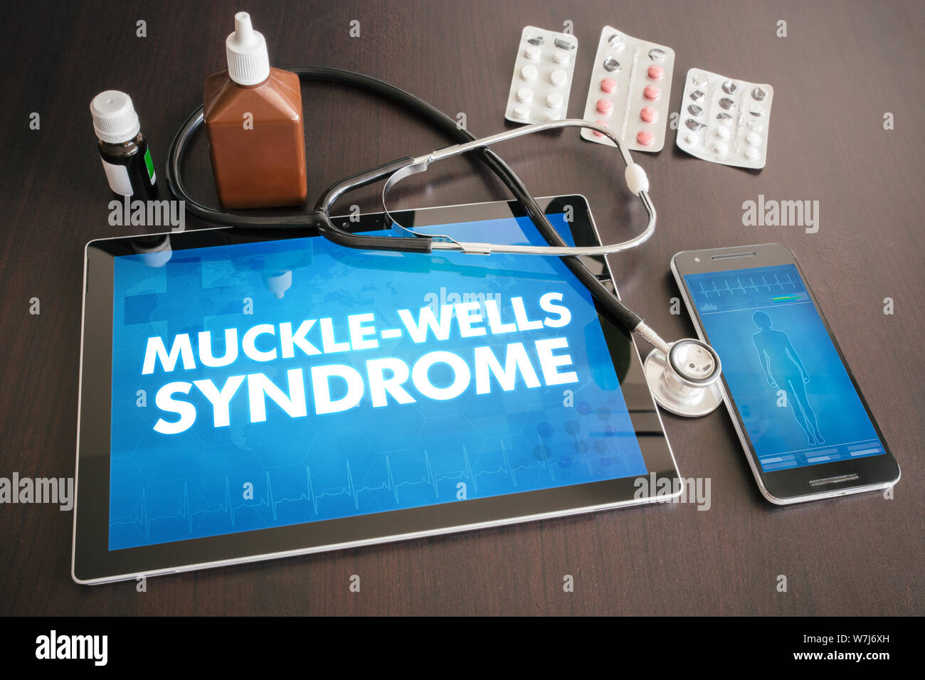 Muckle-Wells syndrome (cutaneous disease) diagnosis medical concept on ...