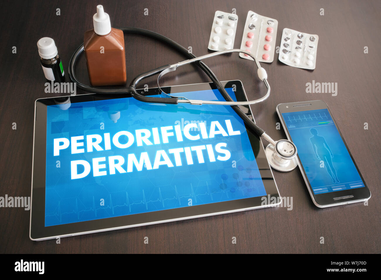 Periorificial dermatitis (cutaneous disease) diagnosis medical concept ...