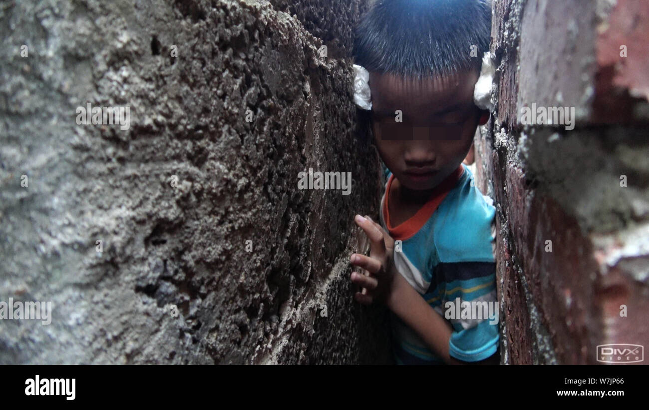 The head of a nine-year-old Chinese boy surnamed Huang gets stuck in a ...