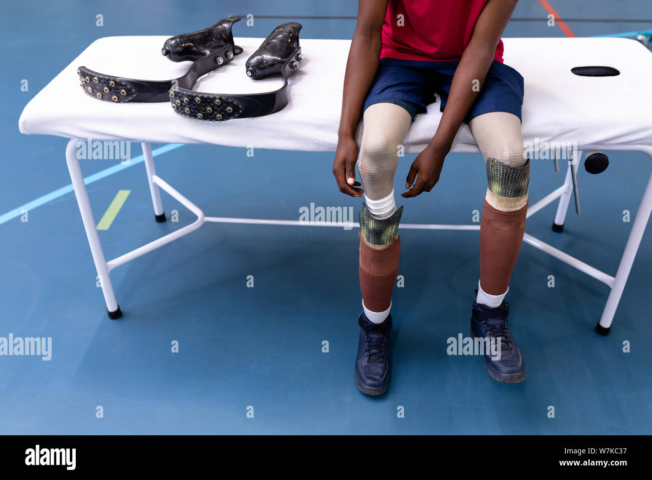 Boy with prosthetic leg hi-res stock photography and images - Alamy