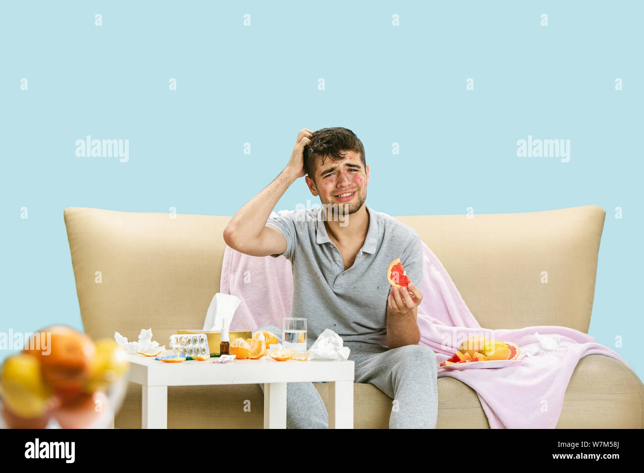 Young man suffering from allergy to citrus fruits. Having skin rash ...