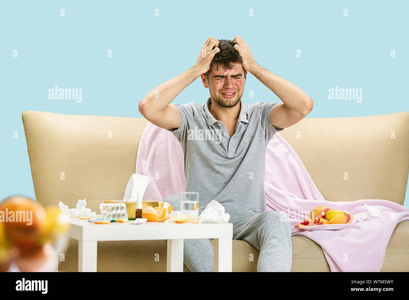 Young man suffering from allergy to citrus fruits. Having skin rash ...