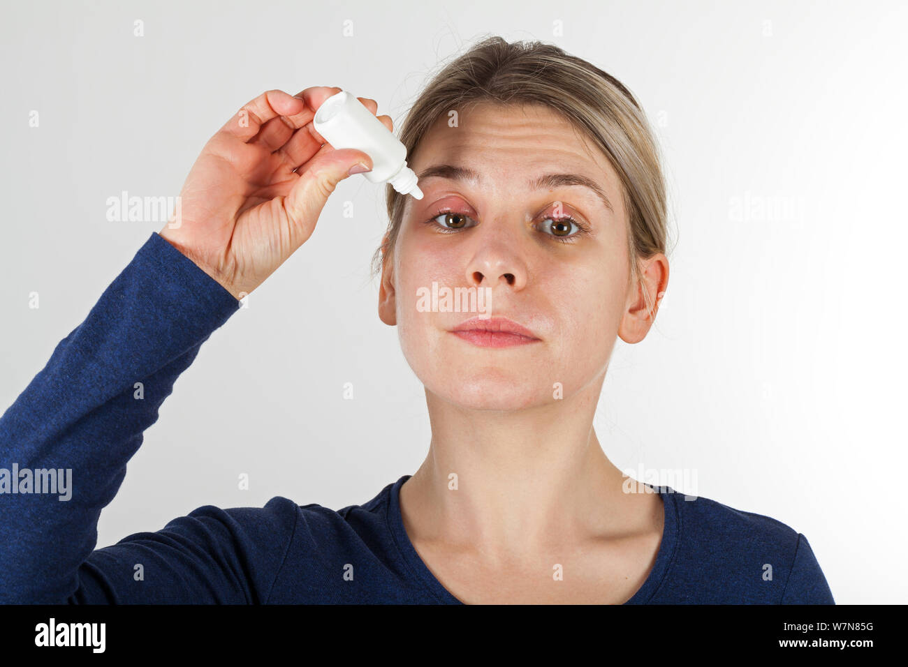 Portrait of a young woman with severe eye infection using medical ...