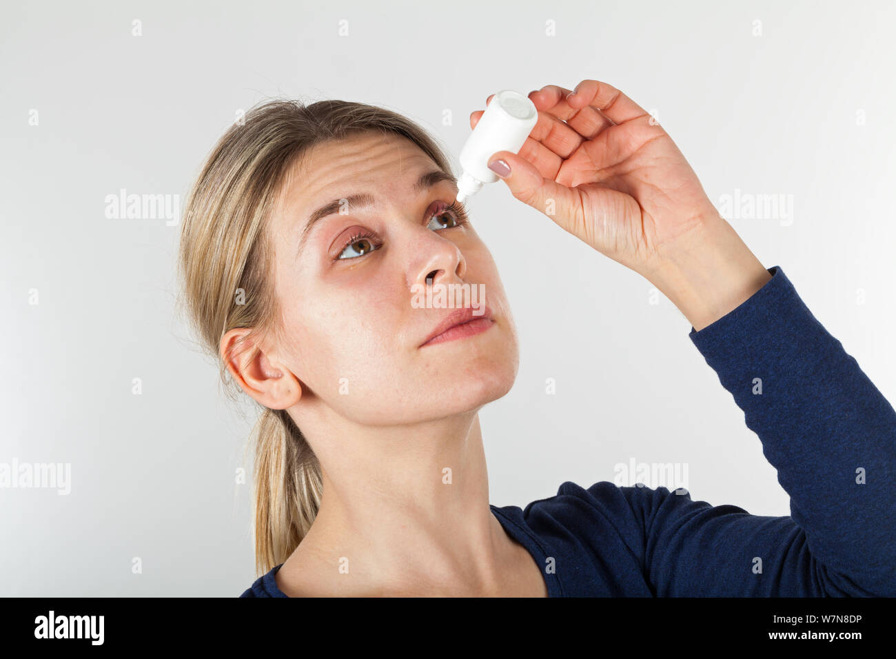 Portrait of a young woman with severe eye infection using medical ...