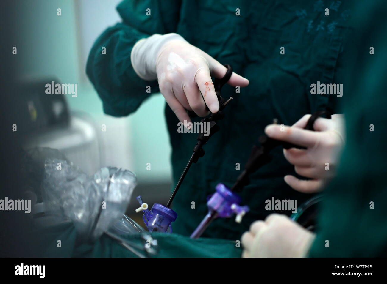 Chinese doctor Jiang Yuequan conducts a surgery on a patient at a tumor ...