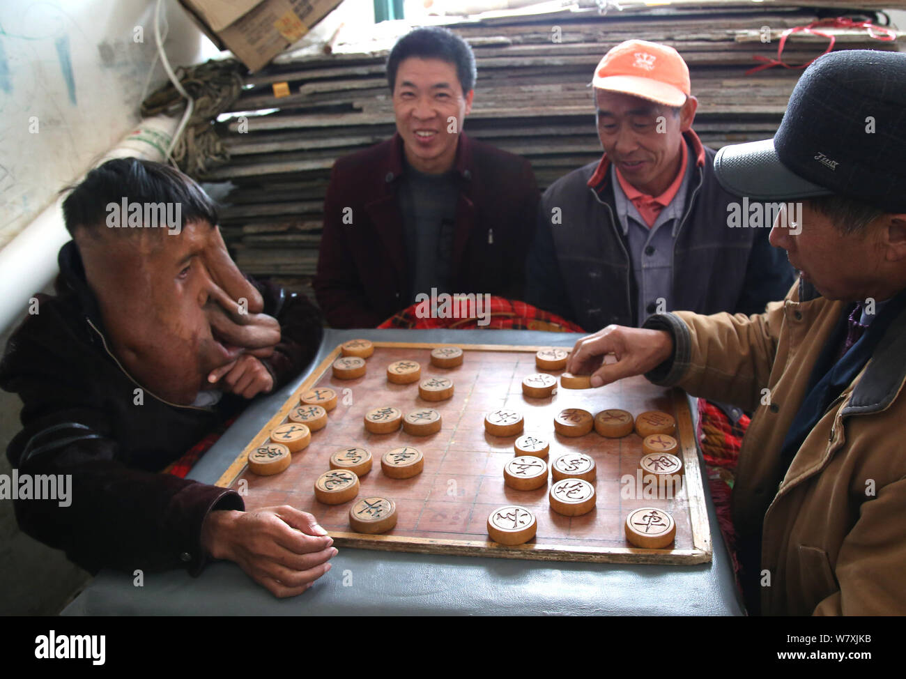 'China's Elephant Man' Huang Chuncai, 41, who suffers from a 15kg huge ...