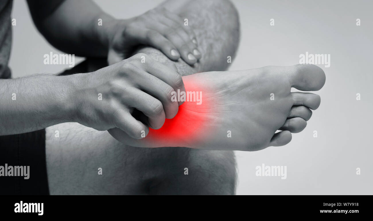 Man scratching itch on his foot with red rash Stock Photo - Alamy