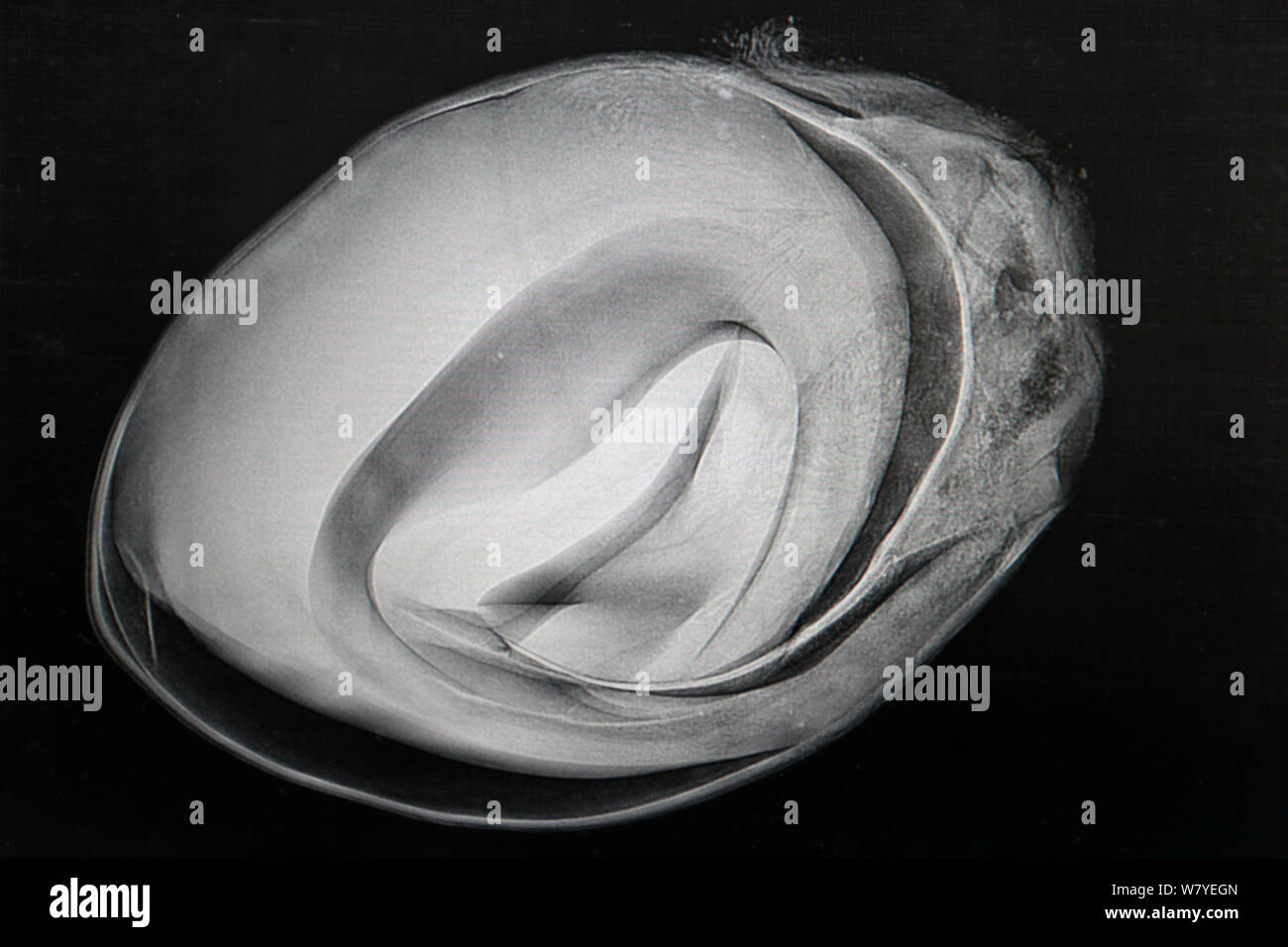 View of an X-ray photo of a plant seed at the Southwest China Germplasm ...