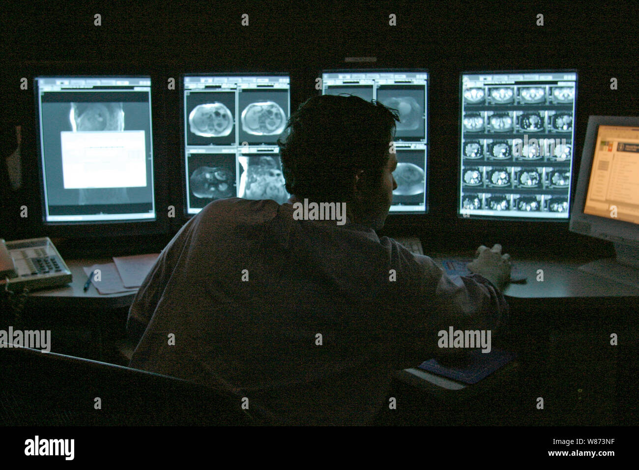 Physician studies images from an MRI at a New York Hospital in ...