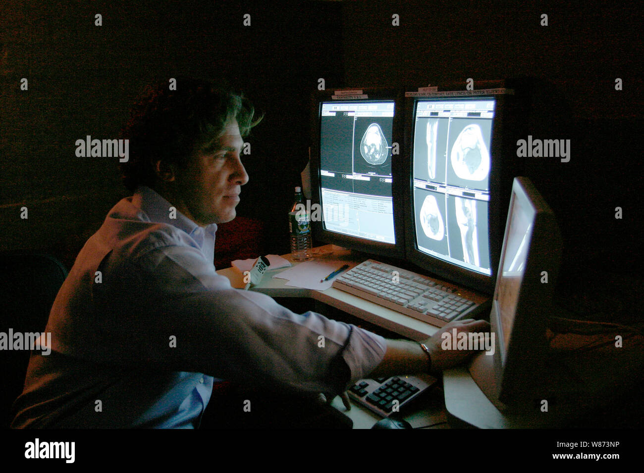 Physician studies images from an MRI at a New York Hospital in ...
