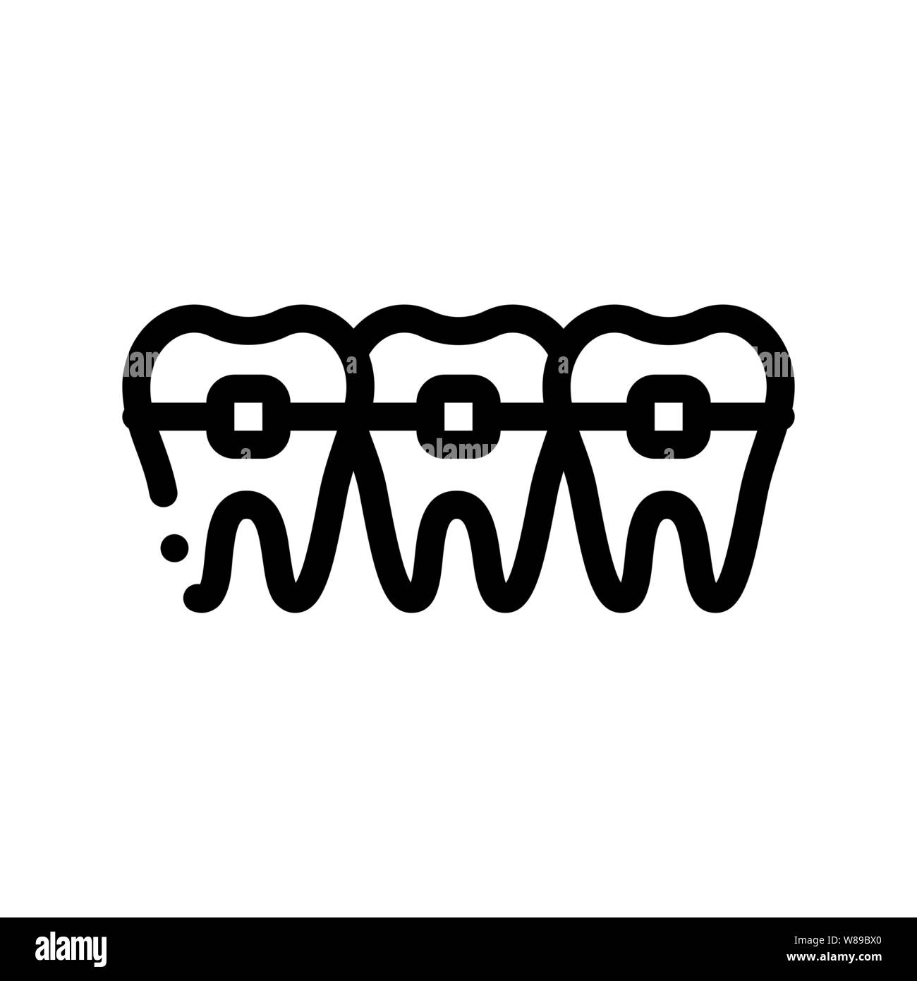 Braces teeth Black and White Stock Photos & Images - Alamy