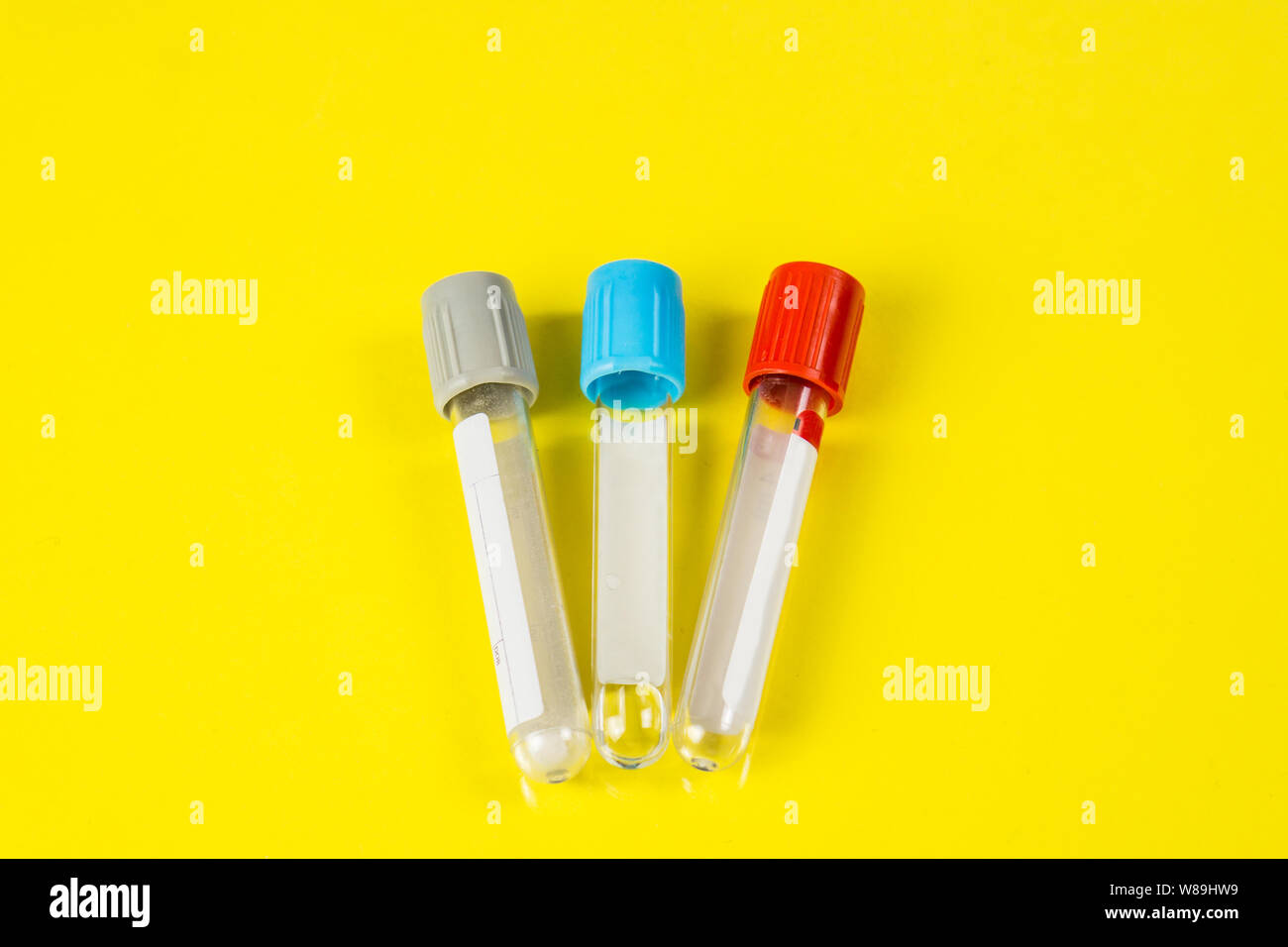 Bottles for samples used in hospitals or medicine for blood samples in ...