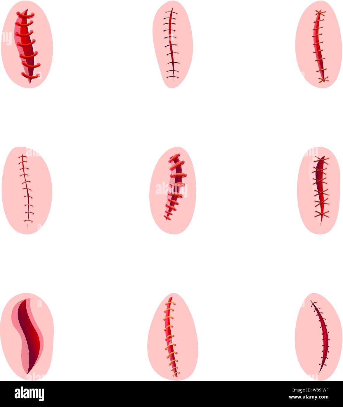 Surgery suture icon set. Cartoon set of 9 surgery suture vector icons ...