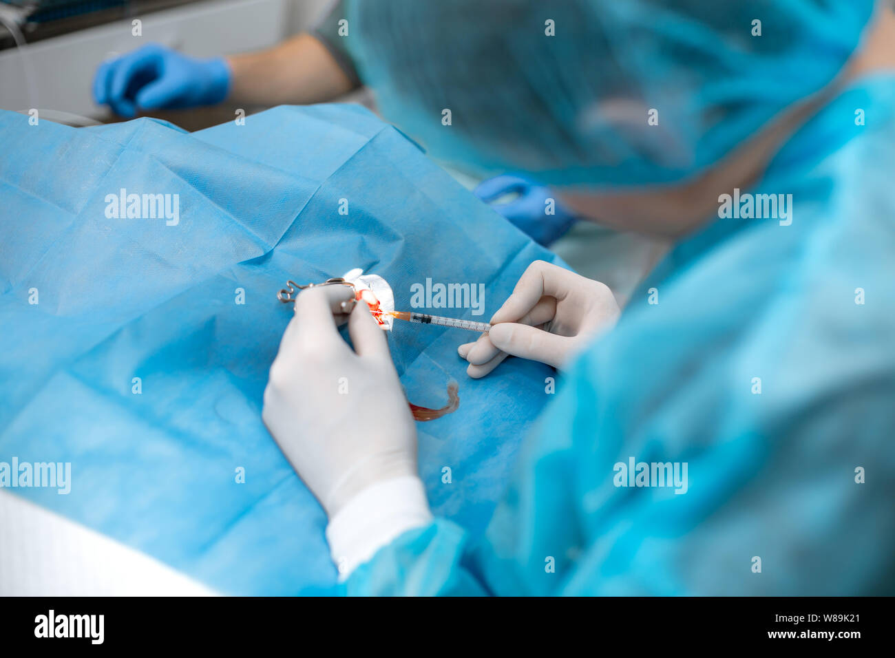 A professional ophthalmologist performs eye surgery with a microscope ...