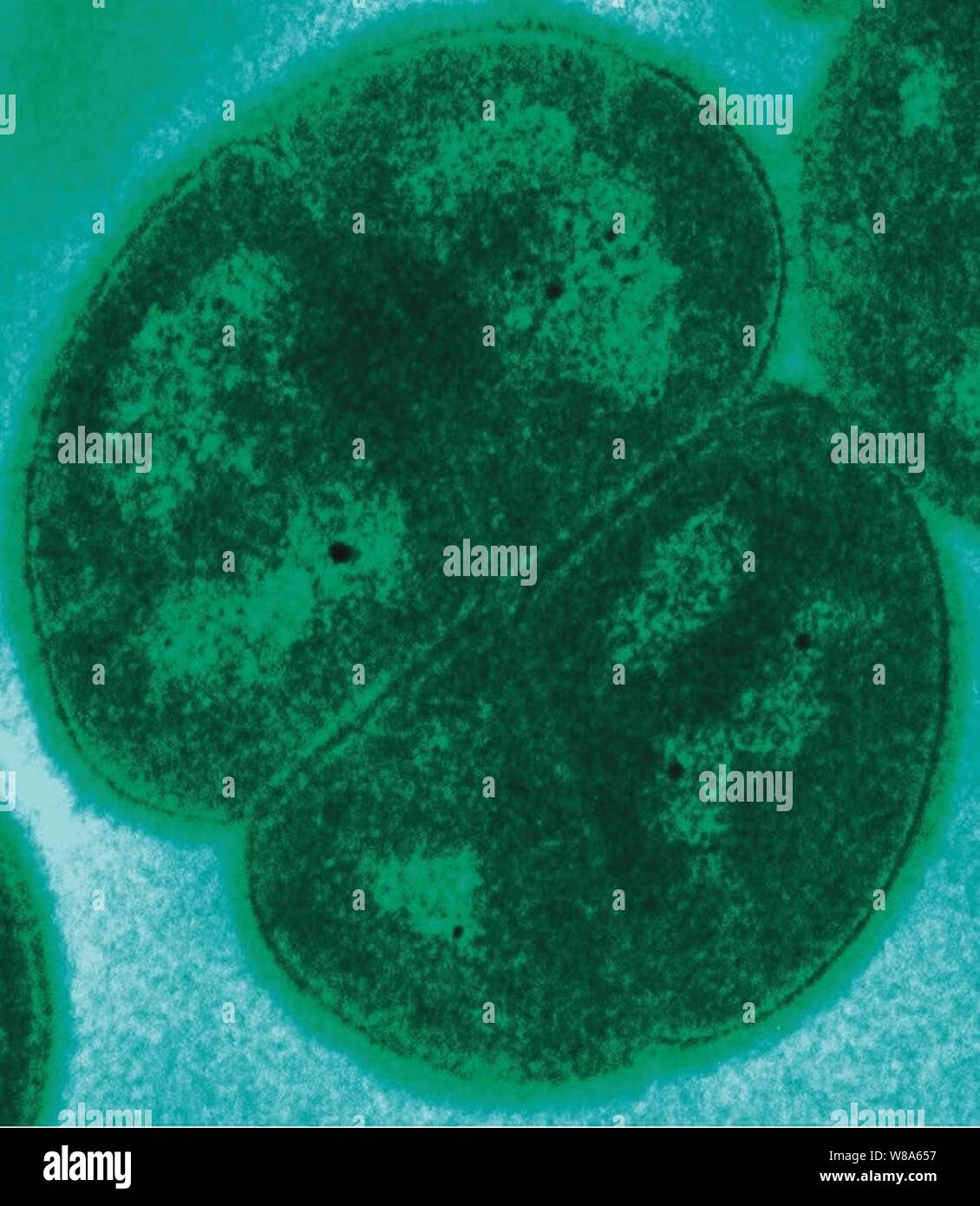 Deinococcus radiodurans hi-res stock photography and images - Alamy