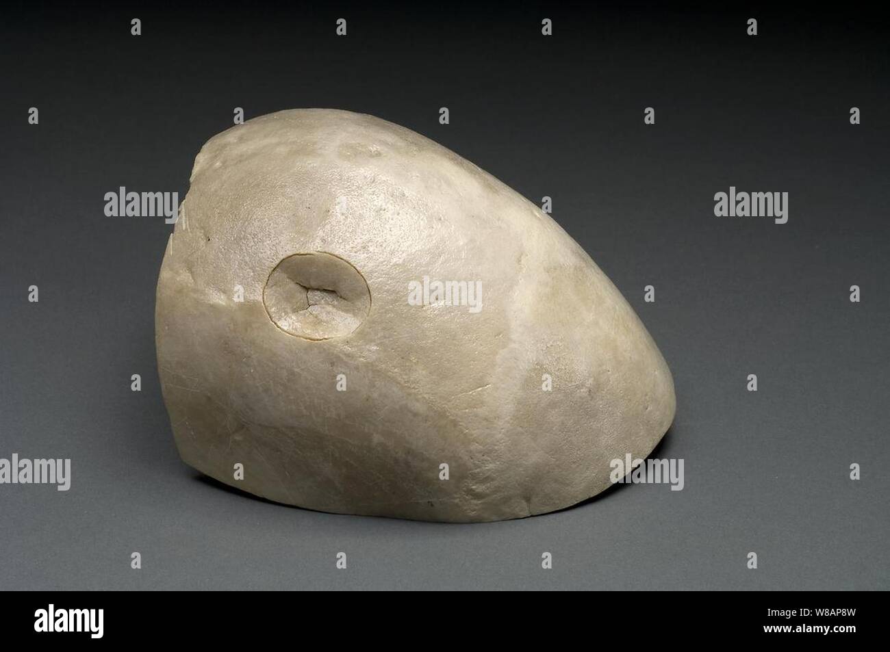 Depressed skull fracture Stock Photo - Alamy