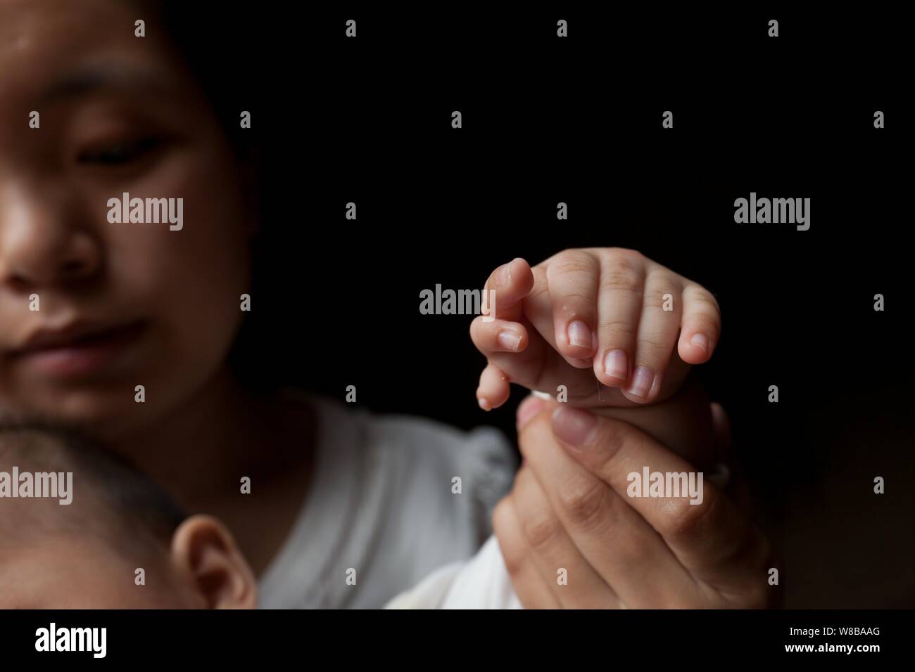 The hand of the three-month-old baby boy Hong Hong who has 15 fingers ...