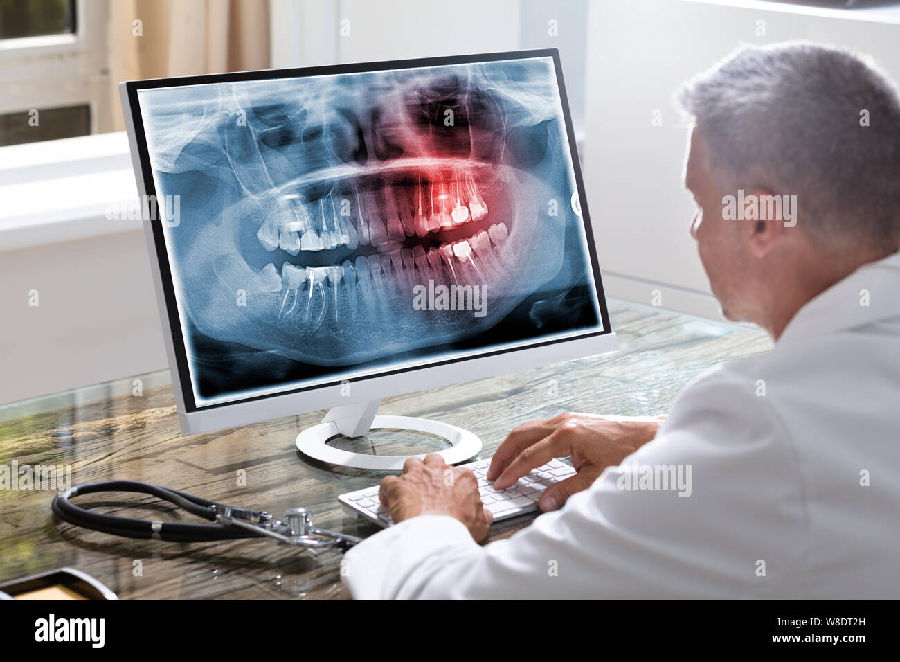 Dentists examining a dental x ray hi-res stock photography and images ...