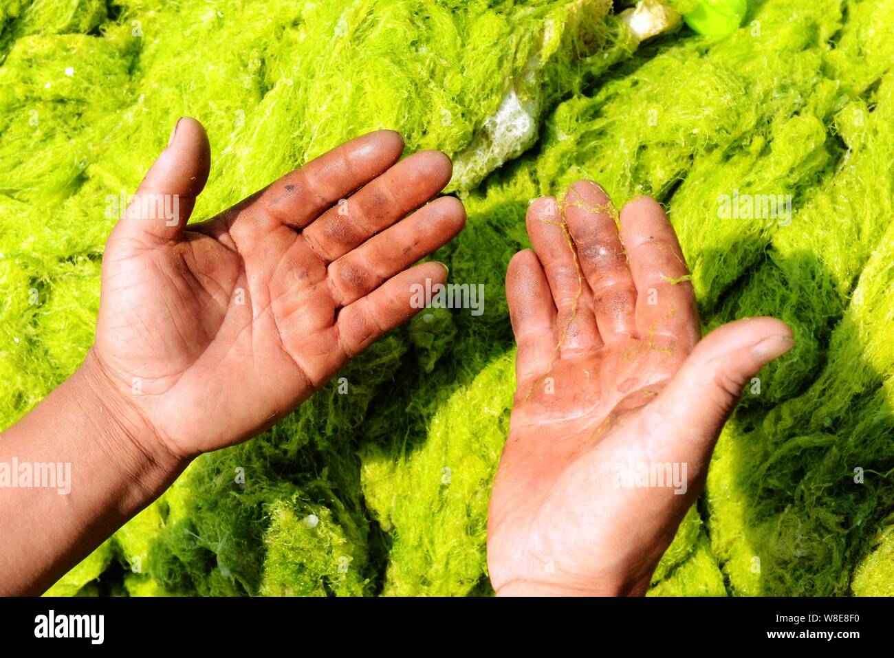 Chinese fisherman Zhang Yanhui shows his hands covered with calluses in ...