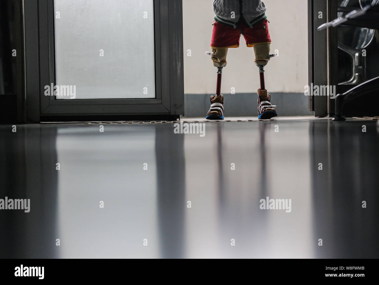 The four-year-old legless boy Xiao Feng stands on his temporary ...