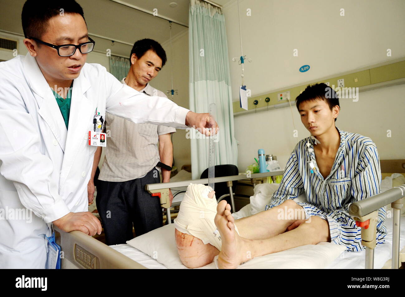 A Chinese doctor measures the gigantic right foot of Liu Huichang ...