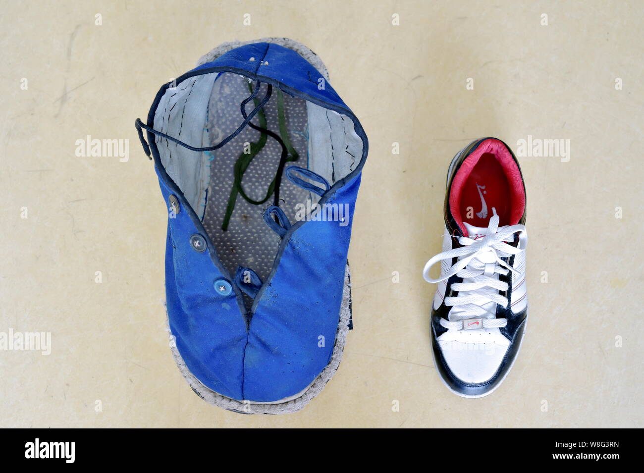 A normal shoe and a gigantic one of Liu Huichang who suffers from local ...