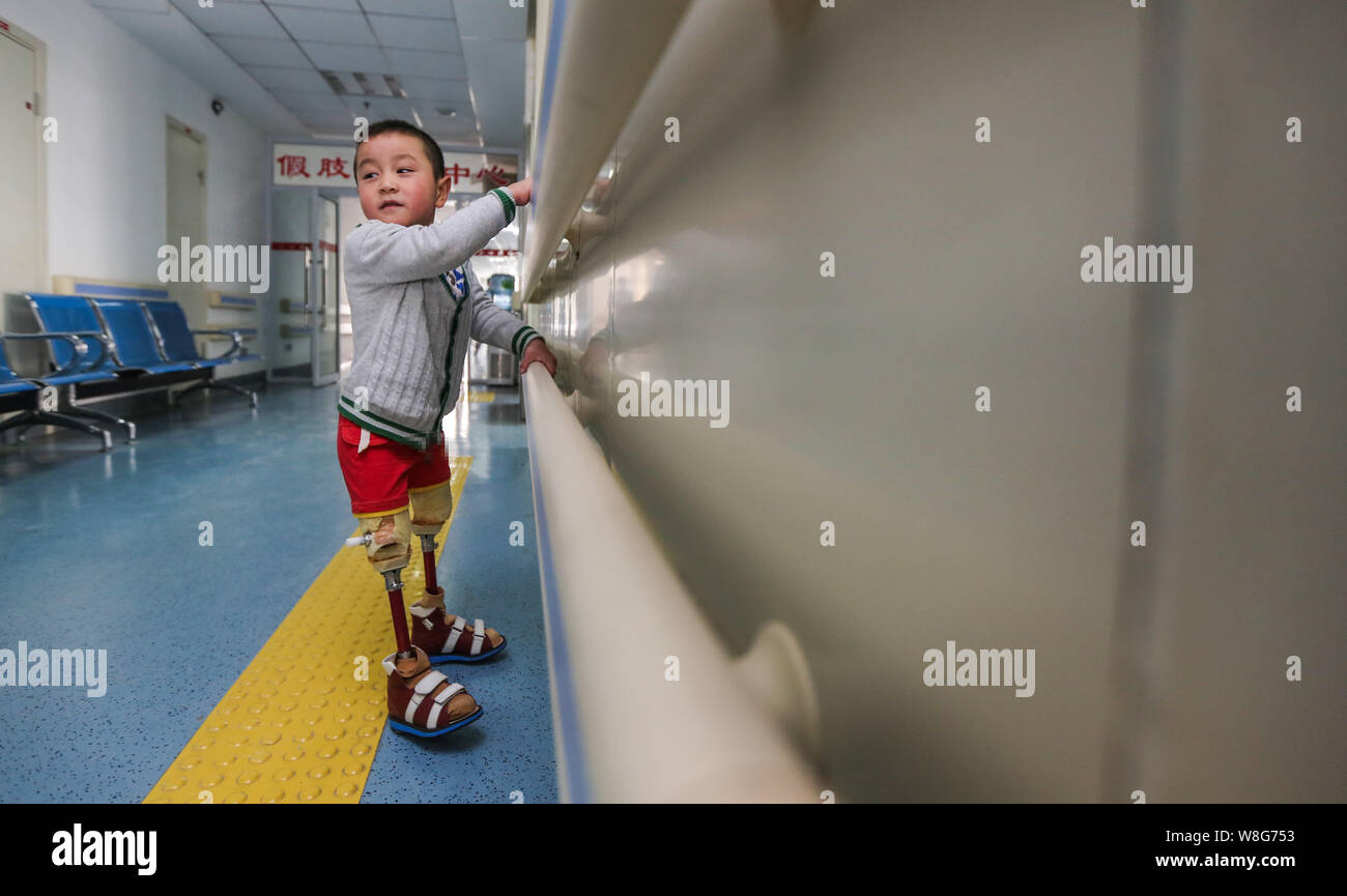 The four-year-old legless boy Xiao Feng stands on his temporary ...