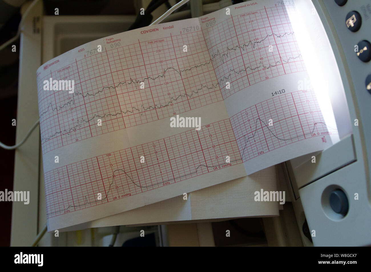 Cardiotocograph hi-res stock photography and images - Alamy