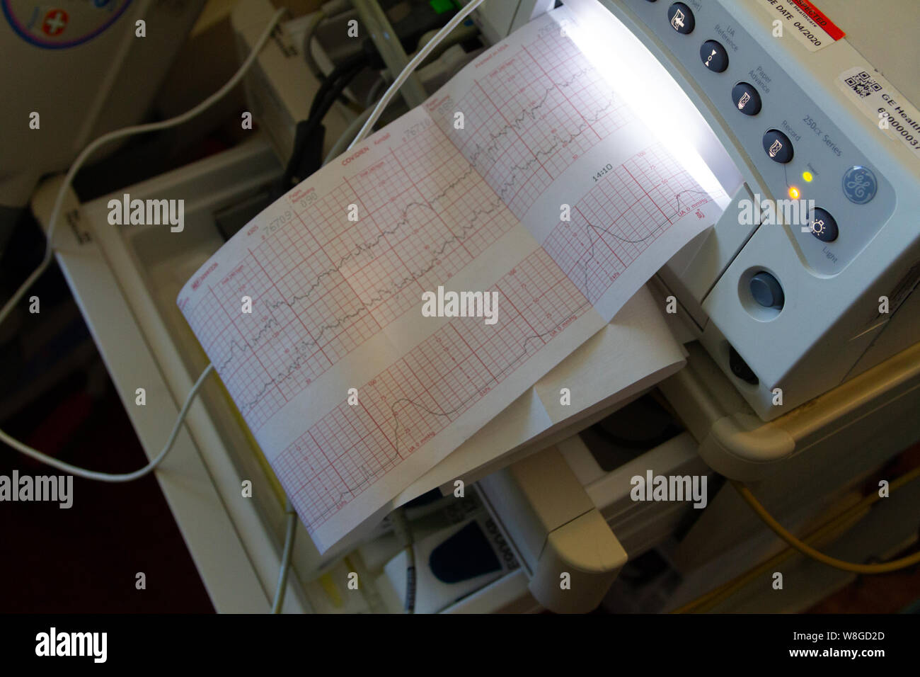 Cardiotocograph hi-res stock photography and images - Alamy