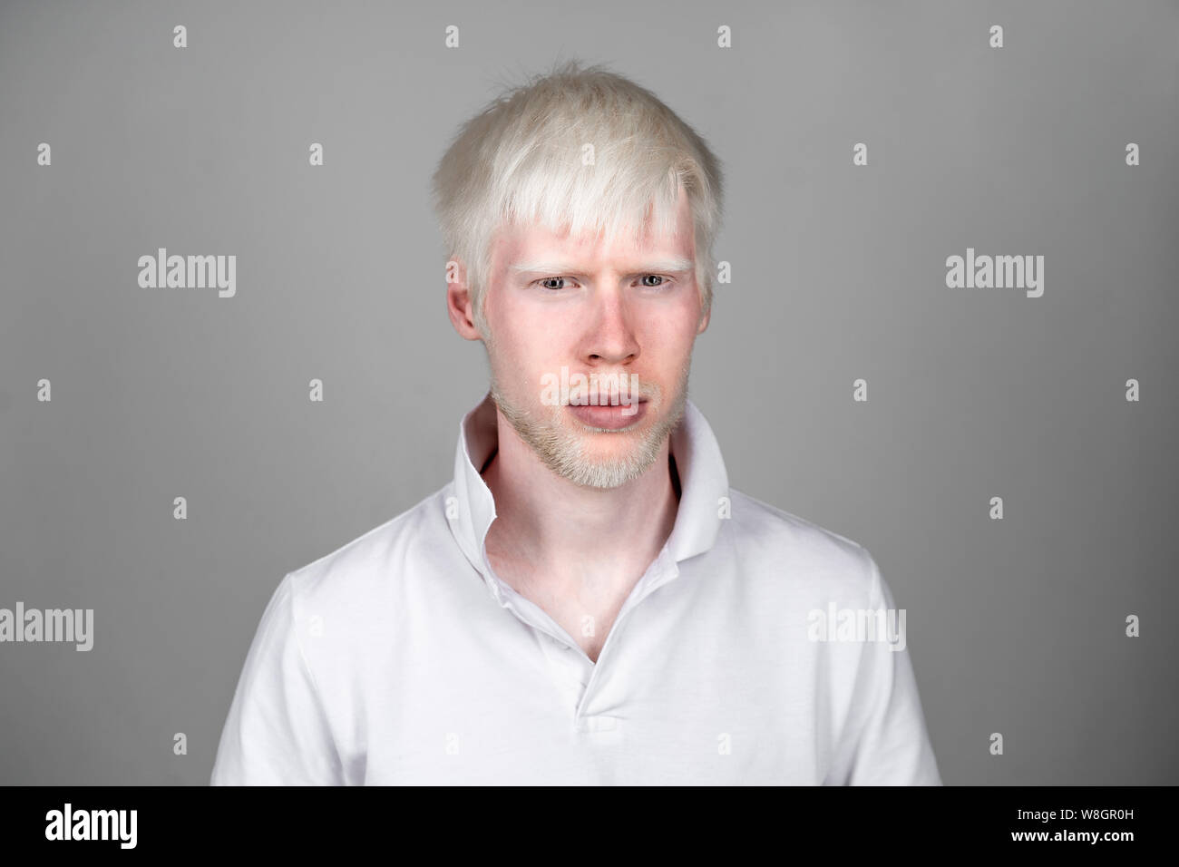 portrait of an albino man in studio dressed t-shirt isolated on a white ...
