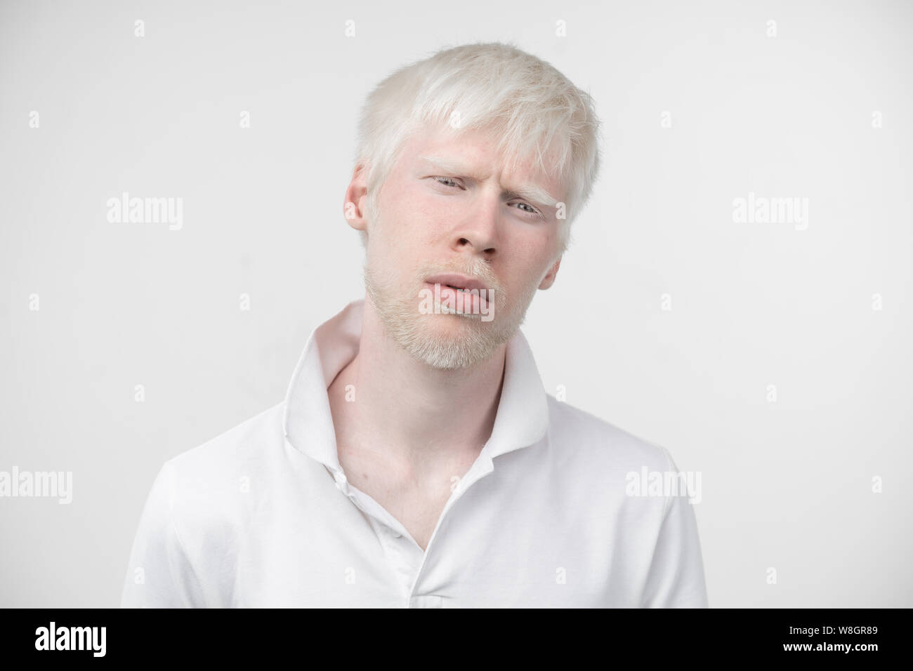 portrait of an albino man in studio dressed t-shirt isolated on a white ...