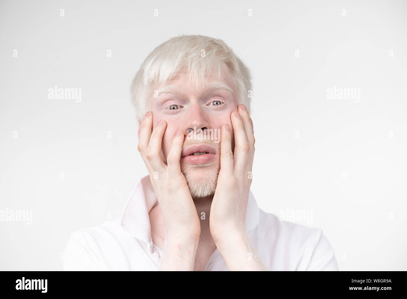 portrait of an albino man in studio dressed t-shirt isolated on a white ...