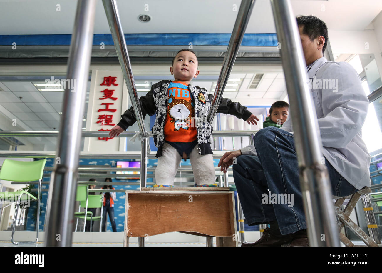 The four-year-old legless boy Xiao Feng stands on molds for his ...