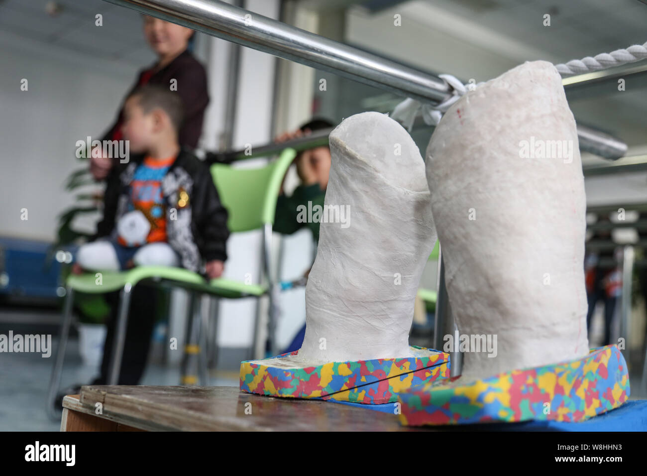 Molds for the silicone prosthetic limbs of the four-year-old legless ...