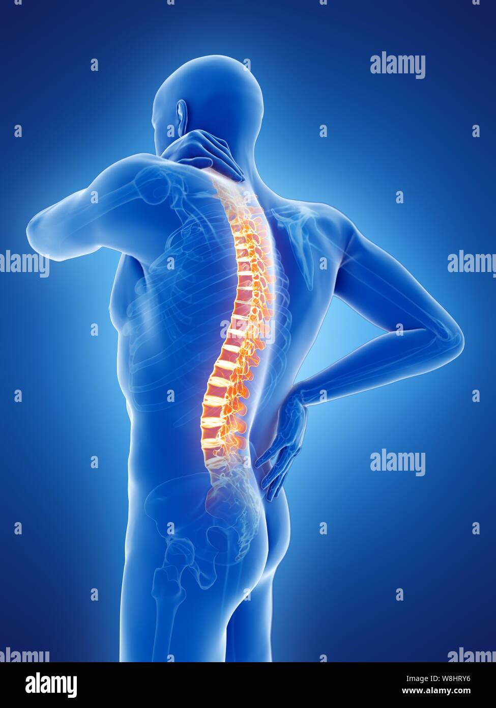 Back pain, computer illustration Stock Photo - Alamy