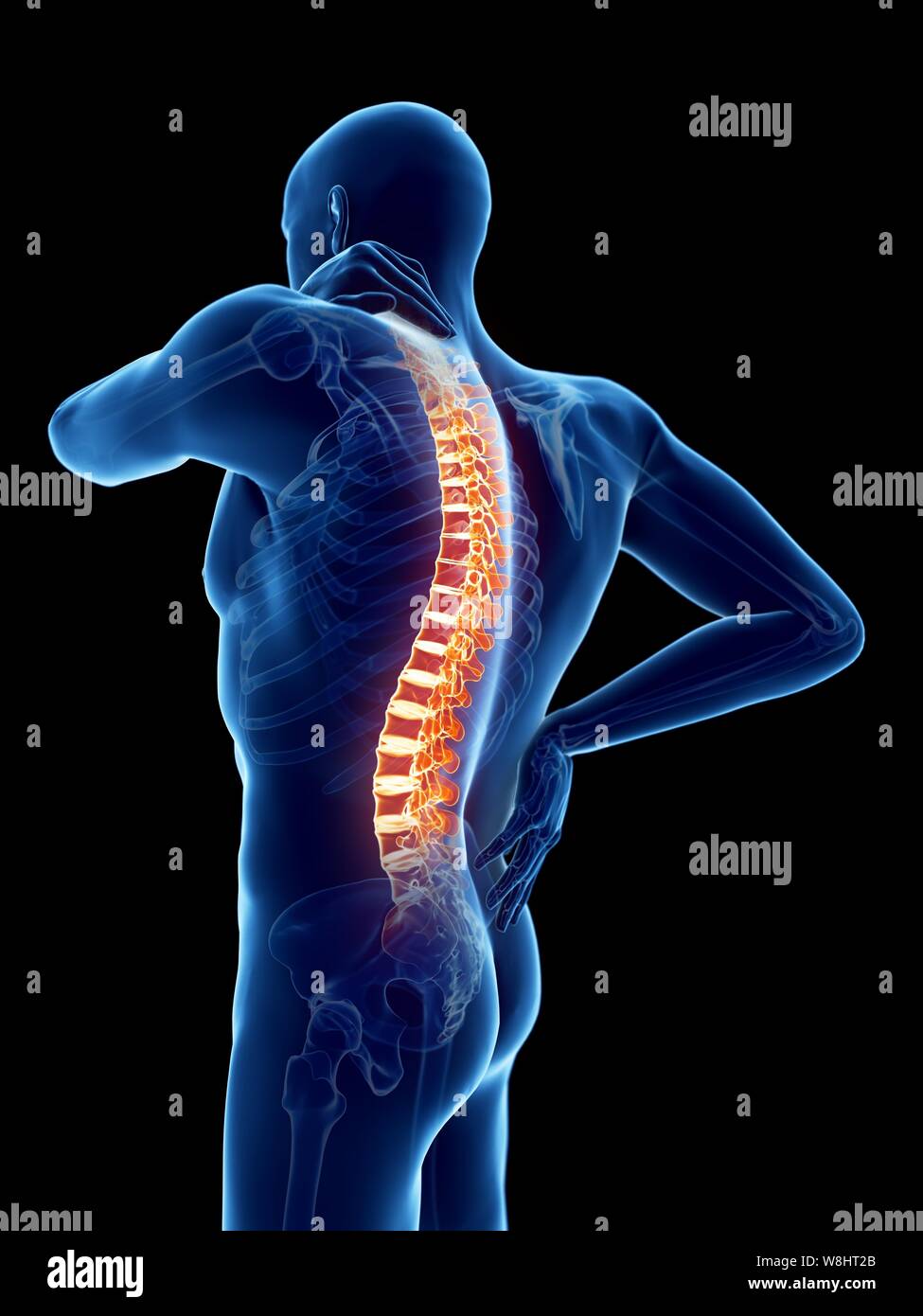 Back pain, computer illustration Stock Photo - Alamy