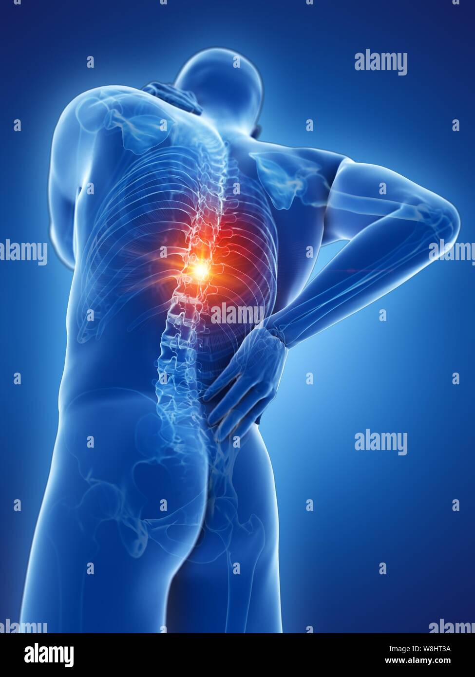 Back pain, computer illustration Stock Photo - Alamy